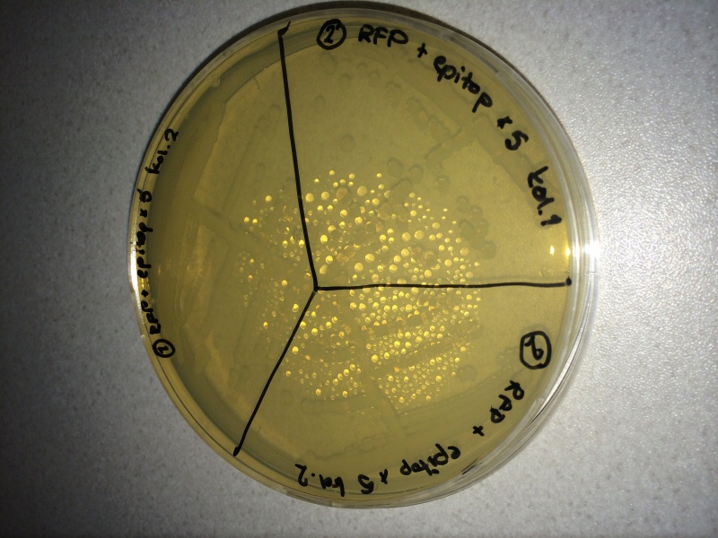 Team:Linkoping Sweden/Parts - 2014.igem.org