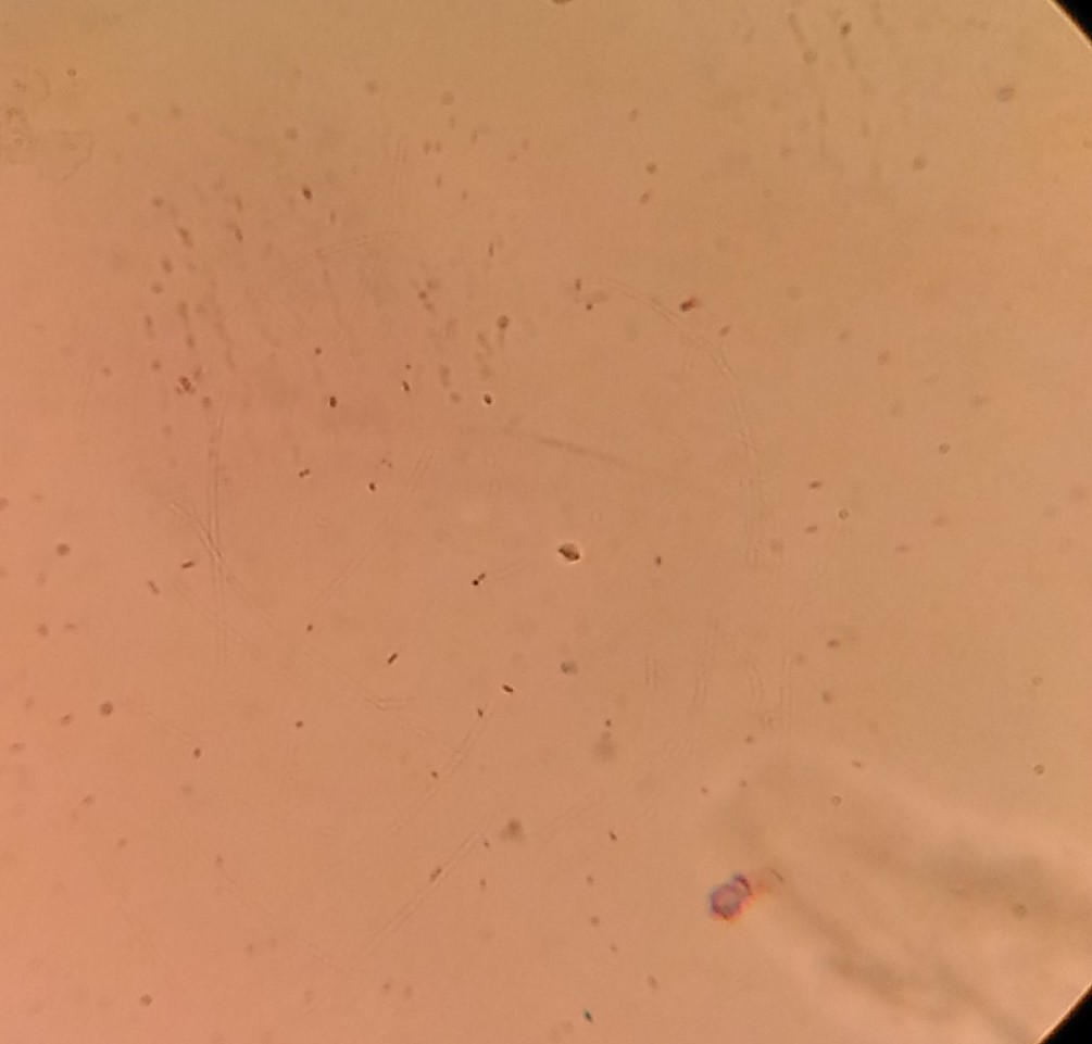 Team:SVCE CHENNAI/Proof - 2016.igem.org