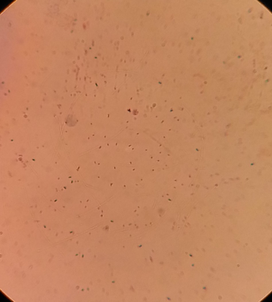 Team:SVCE CHENNAI/Proof - 2016.igem.org