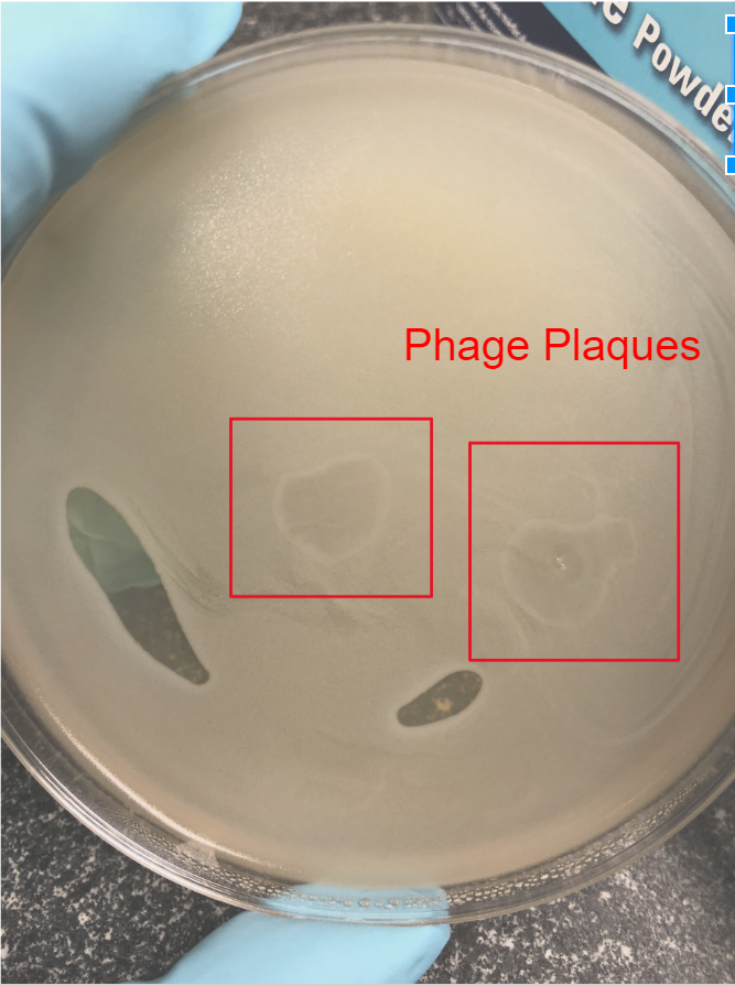 Team:CSU Fort Collins/Phage/ - 2018.igem.org