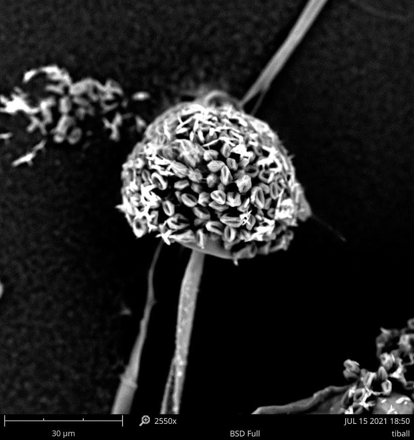 Team:IISER TVM/wetlab fungus - 2021.igem.org